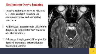 Anatomy Of Oculomotor Nerve.pptx Anatomy of cranial nerves | PPTX | Eye ...