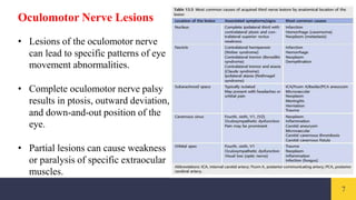 Anatomy Of Oculomotor Nerve.pptx Anatomy of cranial nerves | PPTX | Eye ...