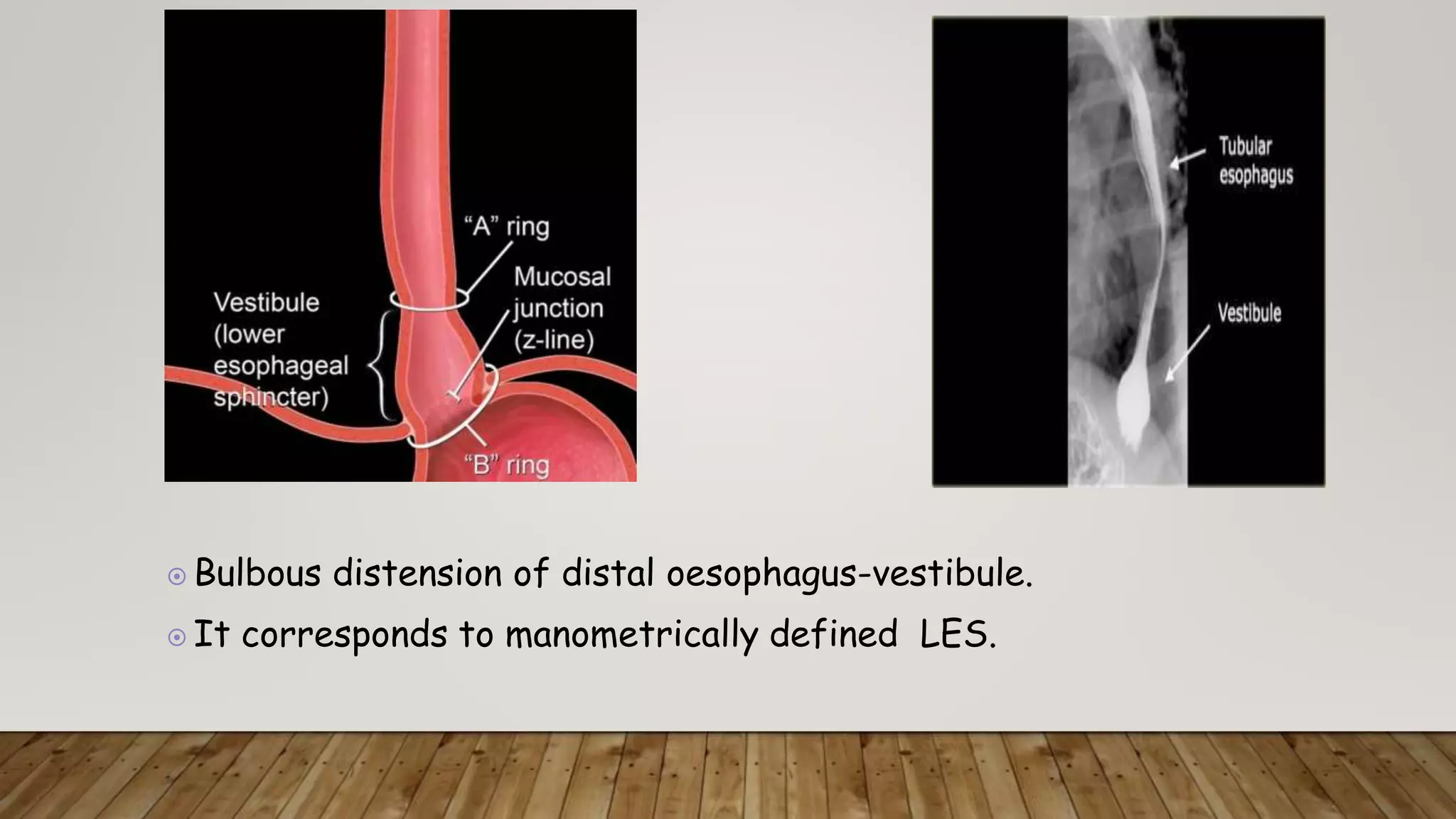 Anatomy of oesophagus | PPTX