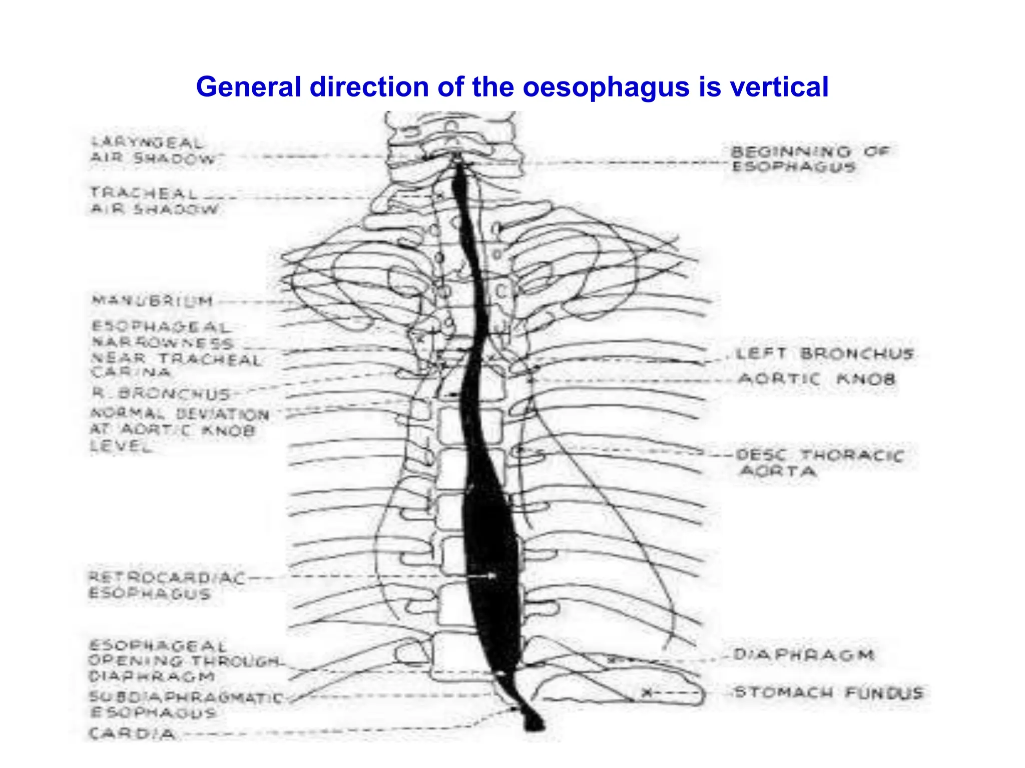 Anatomy of oesophagus.ppt including relations narrow points etc | PPT