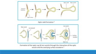 Anatomy of Optic Nerve.pptx