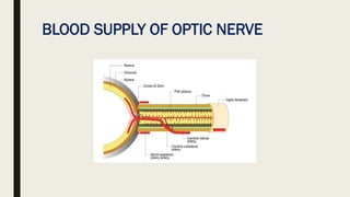 ANATOMY OF OPTIC NERVE.pdf ophthalmology topic | PDF