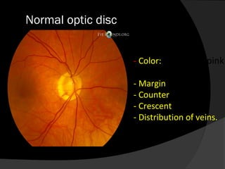 Optic nerve Clinical significance | PPT
