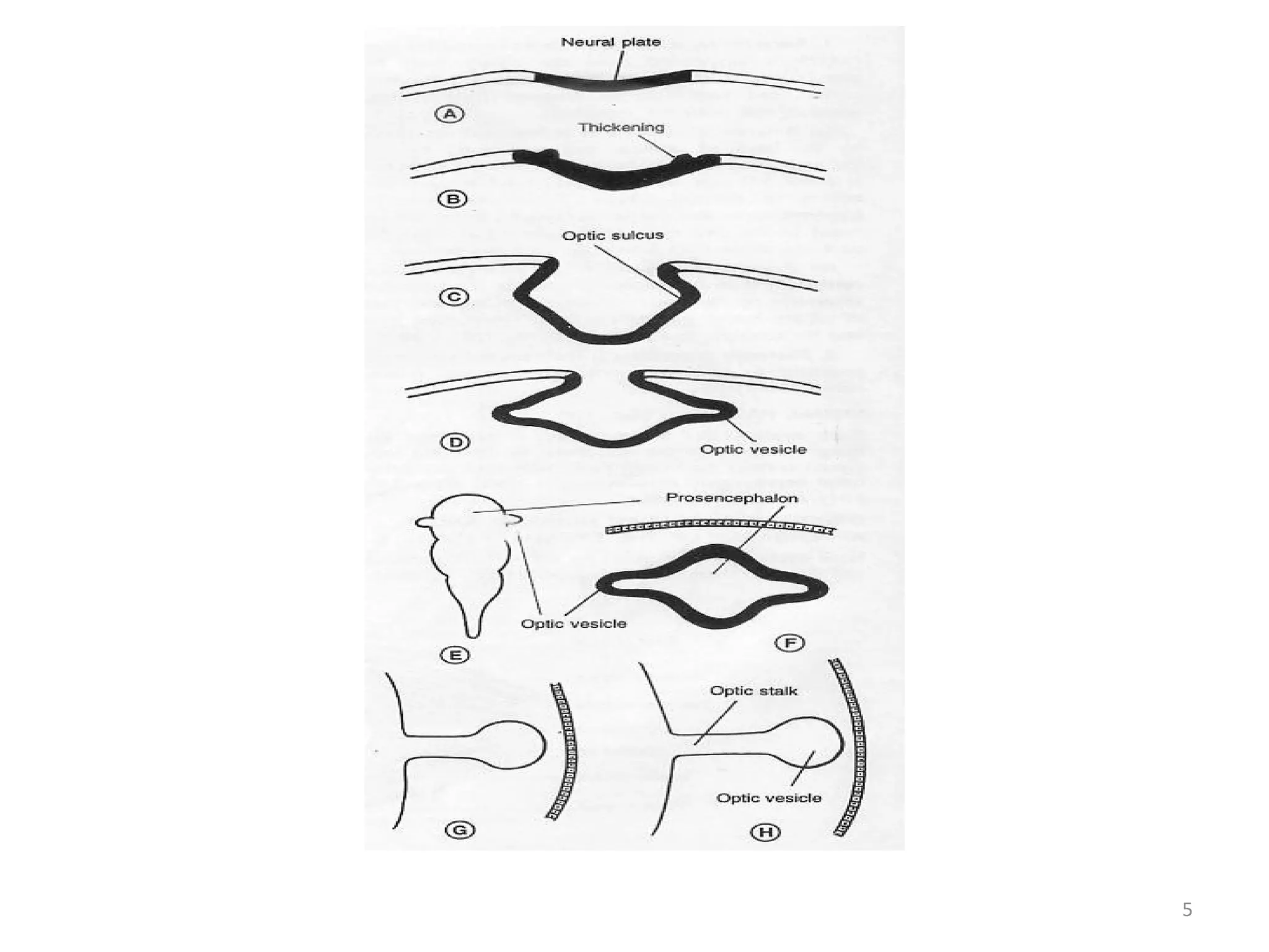 Anatomy Of Optic Nerve And Its Clinical Significance Anatomy Of Optic