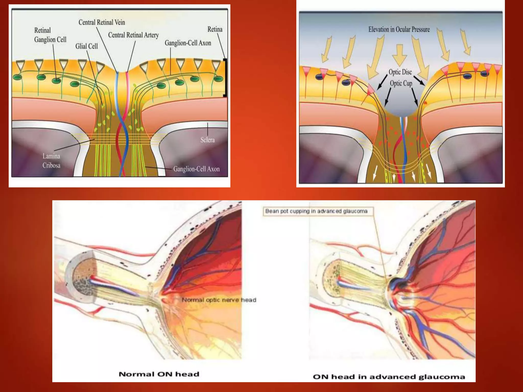 Anatomy of optic nerve (Optic Nerve Anatomy), Blood Supply & Clinical Significance (healthkura ...