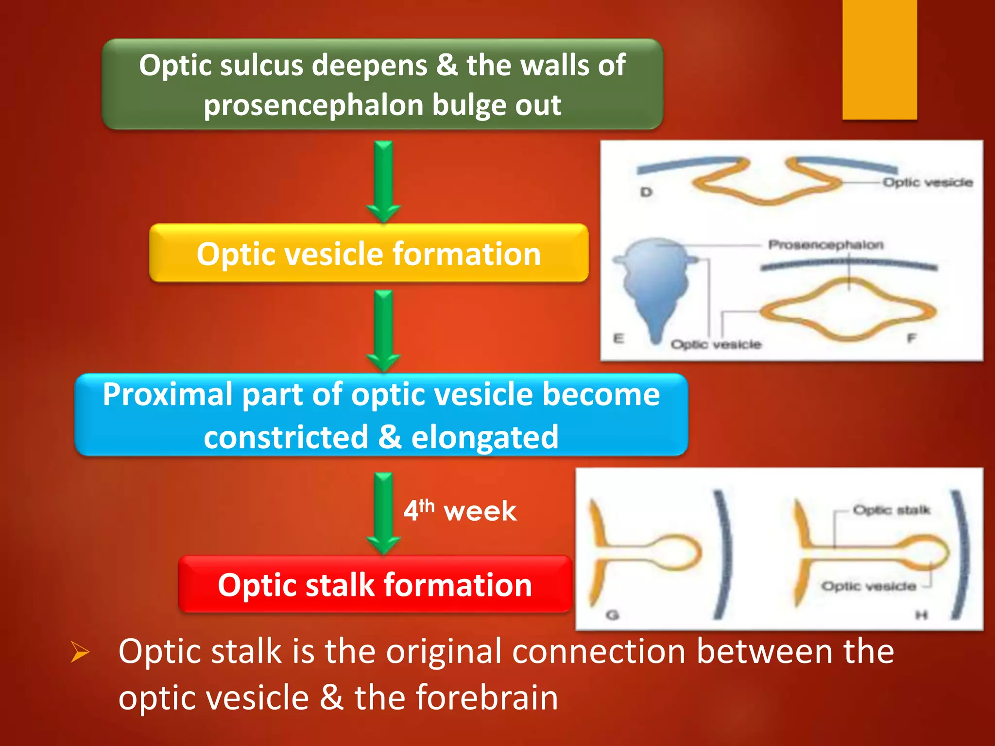 Anatomy of optic nerve (Optic Nerve Anatomy), Blood Supply & Clinical ...