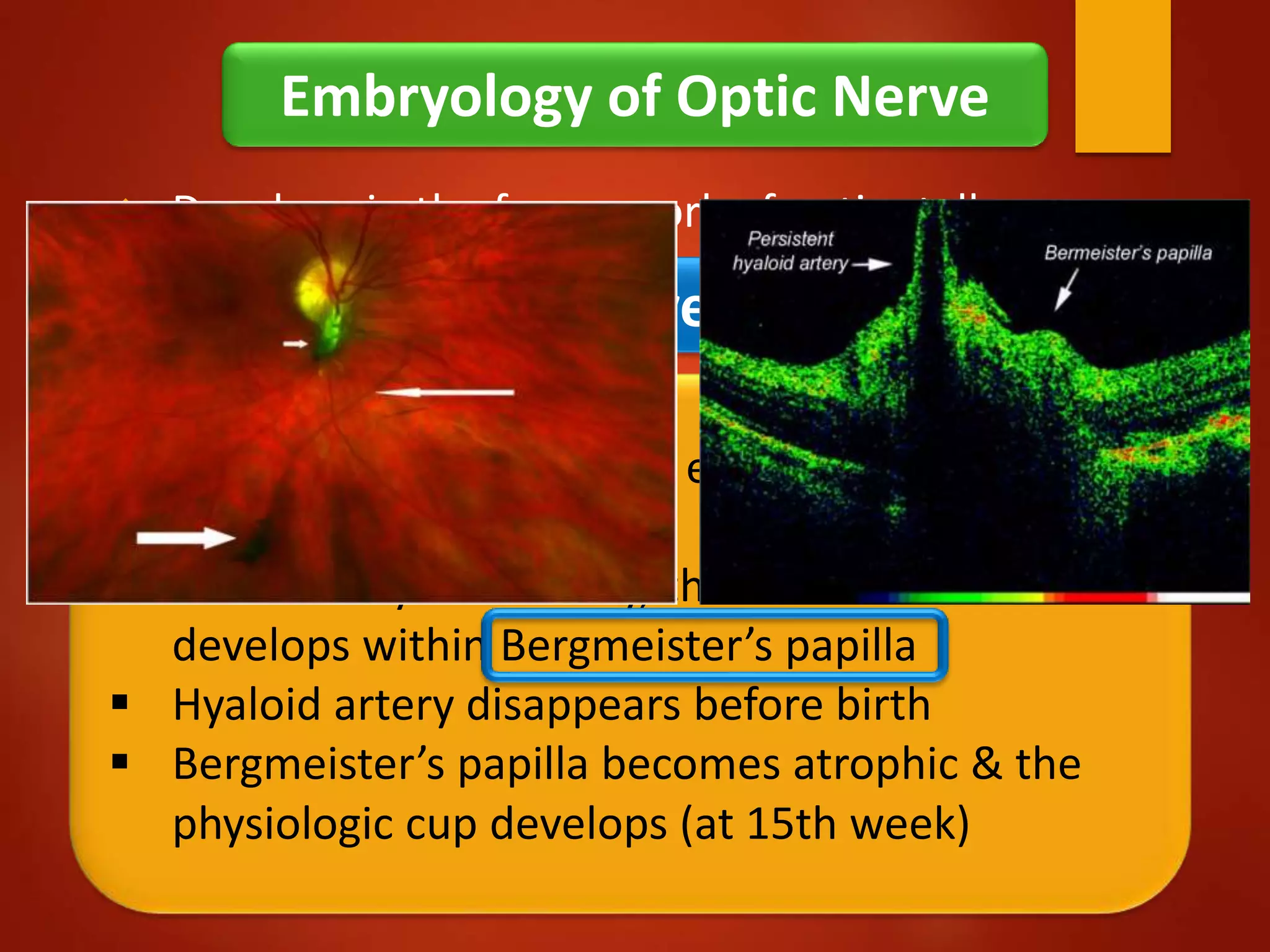 Anatomy of optic nerve (Optic Nerve Anatomy), Blood Supply & Clinical ...