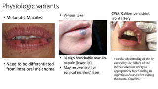 Anatomy of Oral Cavity with applied anatomy.pptx