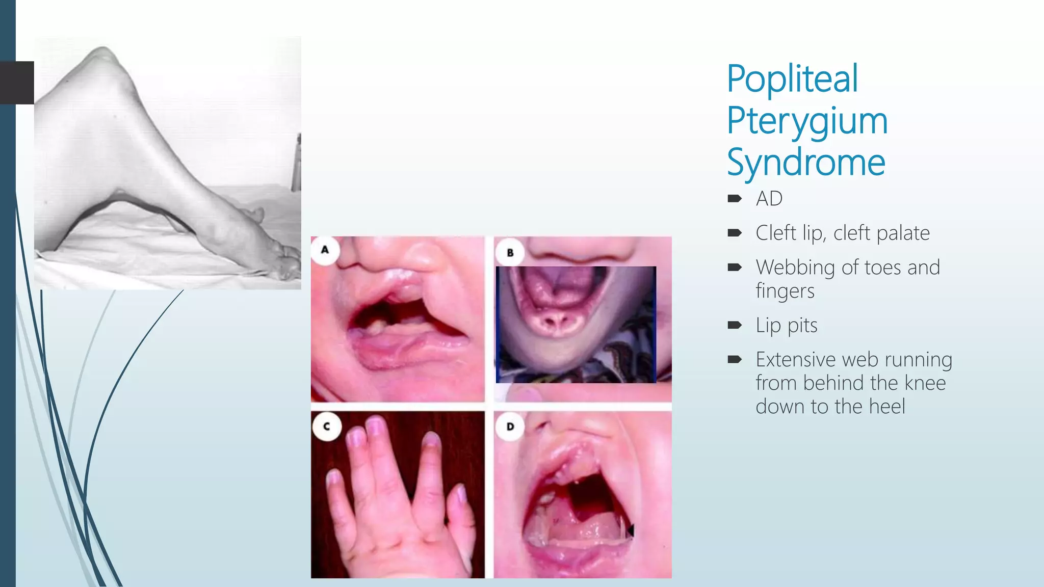 Anatomy and Physiology of Oral Cavity & Oropharynx | PPTX
