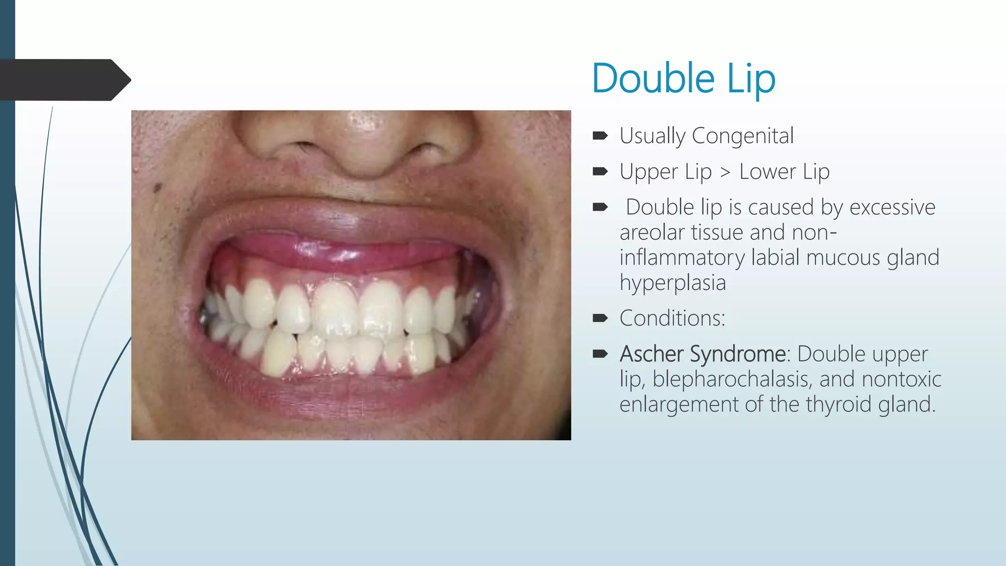 Anatomy and Physiology of Oral Cavity & Oropharynx | PPTX
