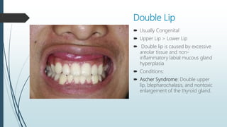 Anatomy and Physiology of Oral Cavity & Oropharynx | PPTX