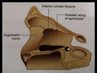Anatomy of orbit | PPTX