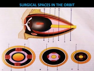 Anatomy of orbit | PPTX