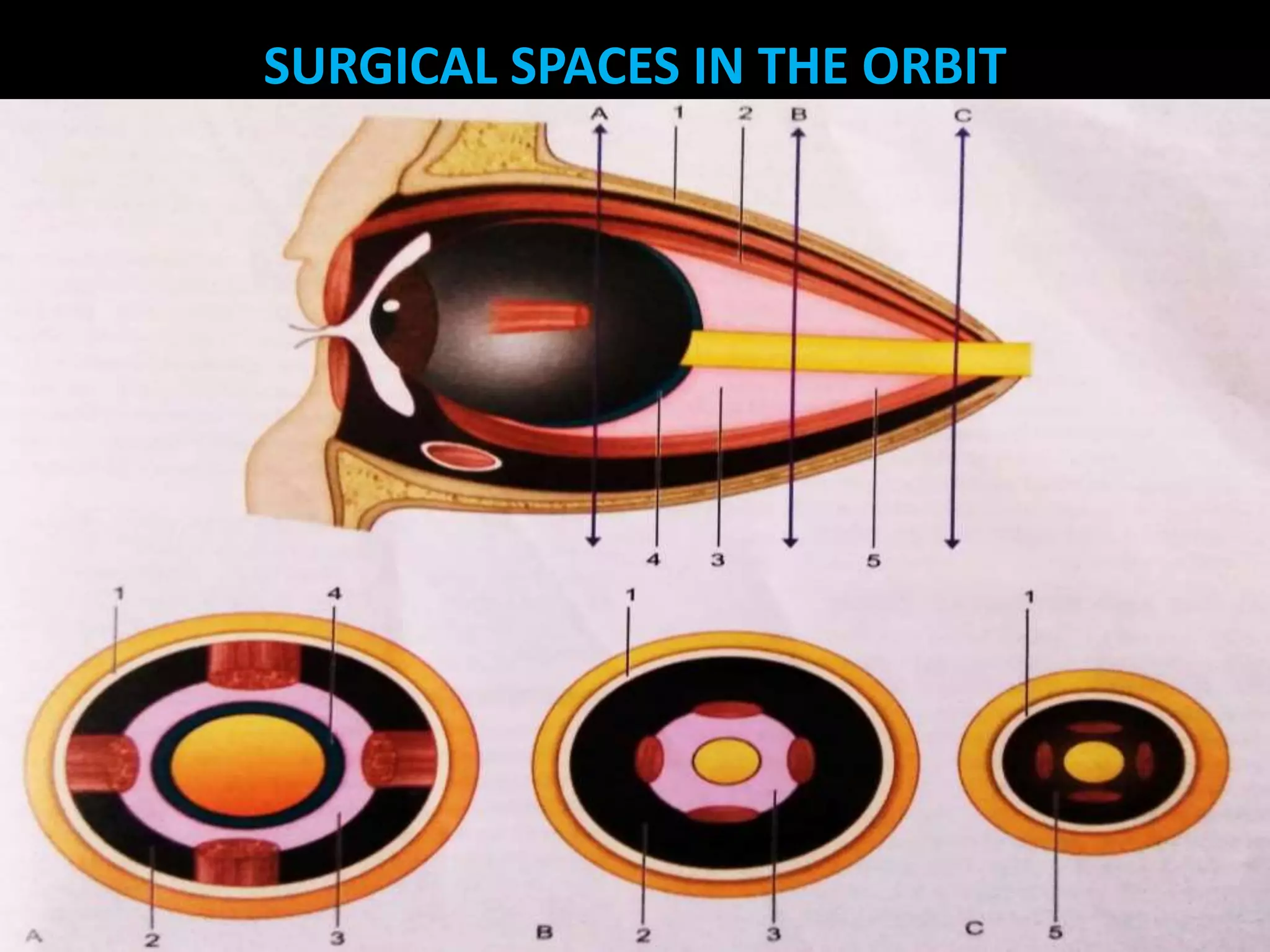 Anatomy of orbit | PPTX | Ear, Nose and Throat Conditions | Diseases ...