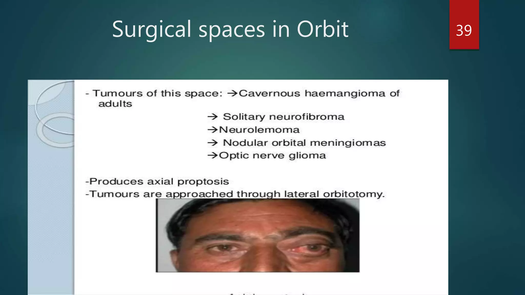 Anatomy of orbit | PPTX