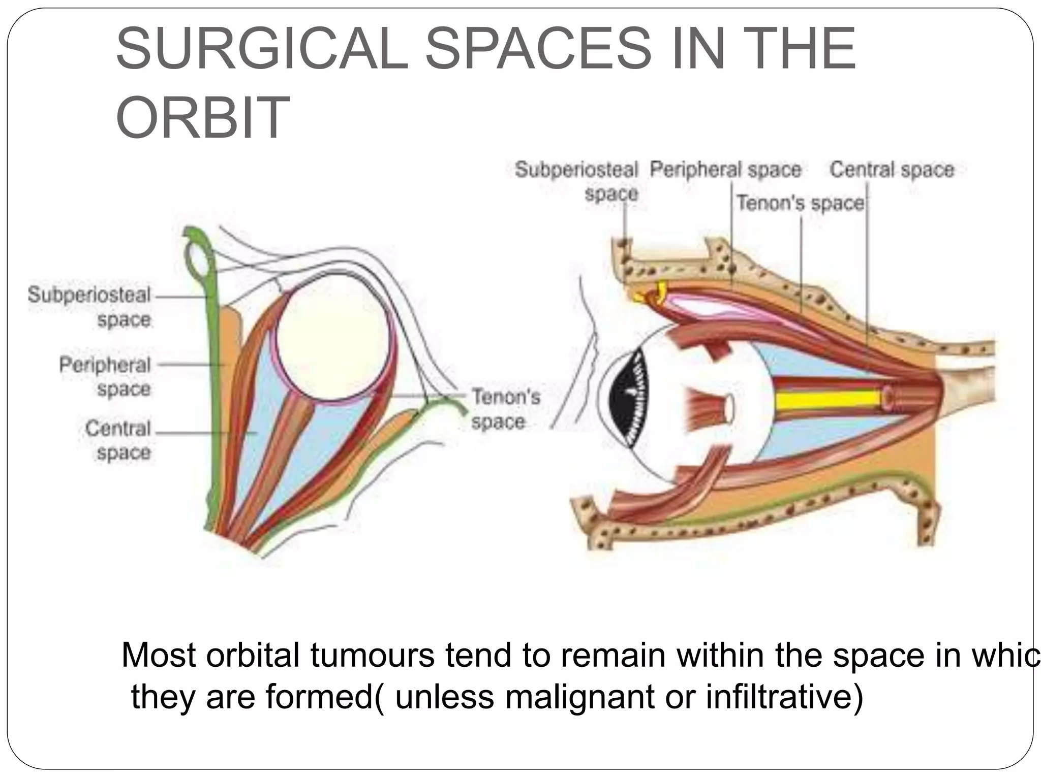 Anatomy of orbit | PPTX