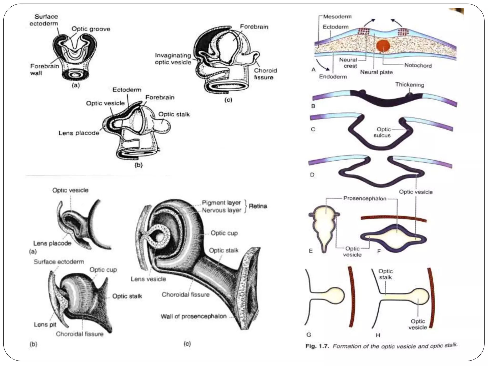 Anatomy of Orbit and its clinical importance | PPTX