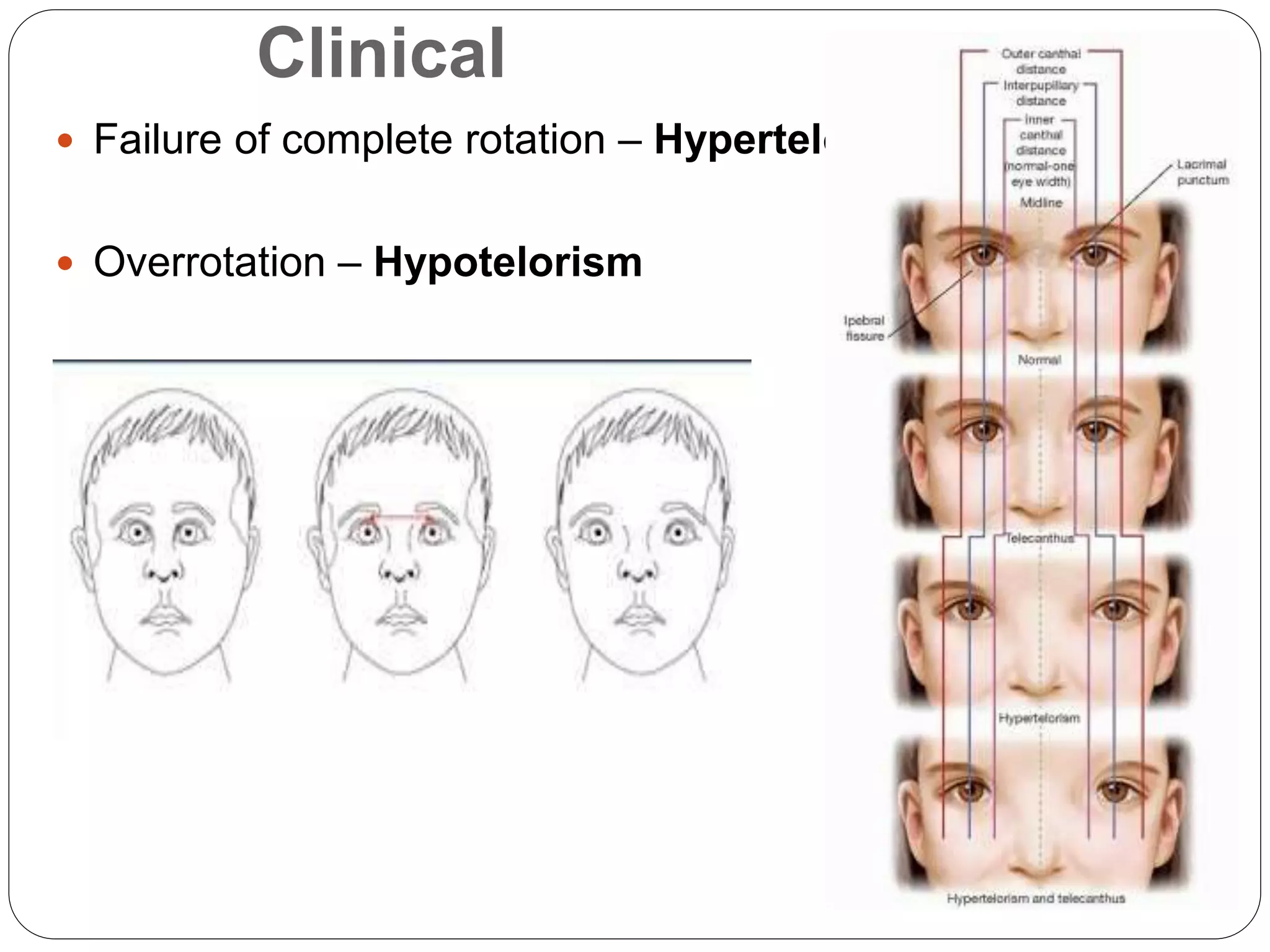 Anatomy of Orbit and its clinical importance | PPTX