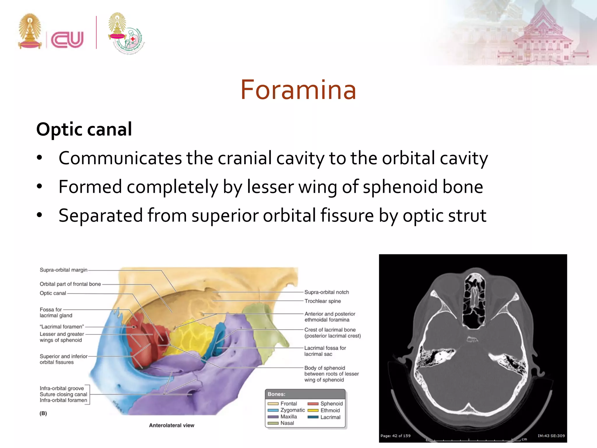 Anatomy of Orbit and Lacrimal system | PDF