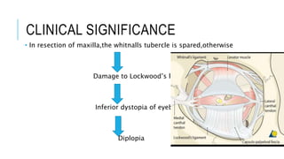 Anatomy of orbit ophthalm | PPTX