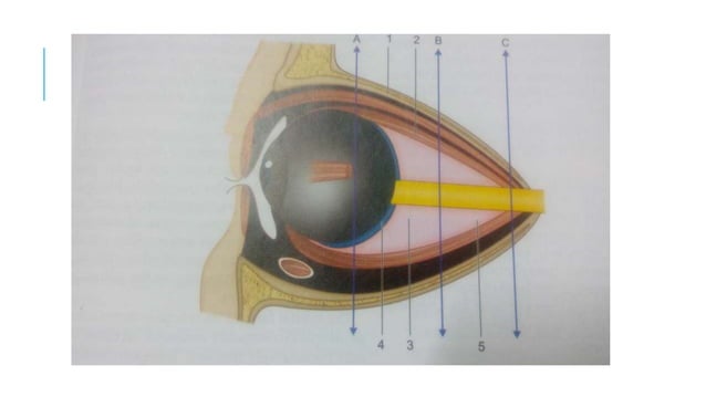 Anatomy of orbit ophthalm | PPTX