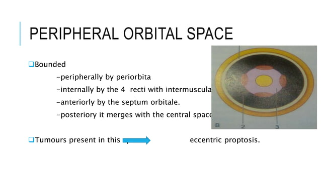 Anatomy of orbit ophthalm | PPTX