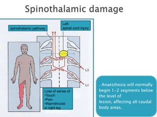 Anatomy of pain pathway | PPTX