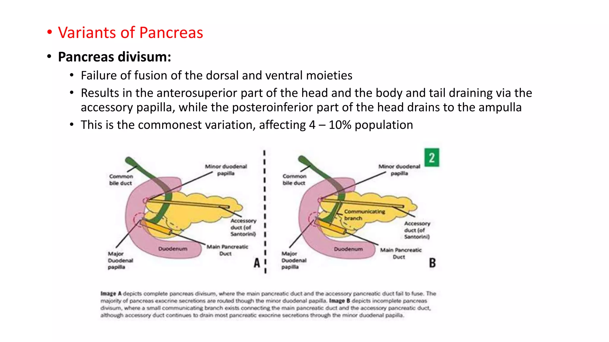 Radiological Anatomy of pancreas | PPTX