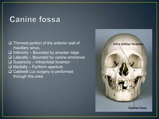 Anatomy of para nasal sinuses | PPTX