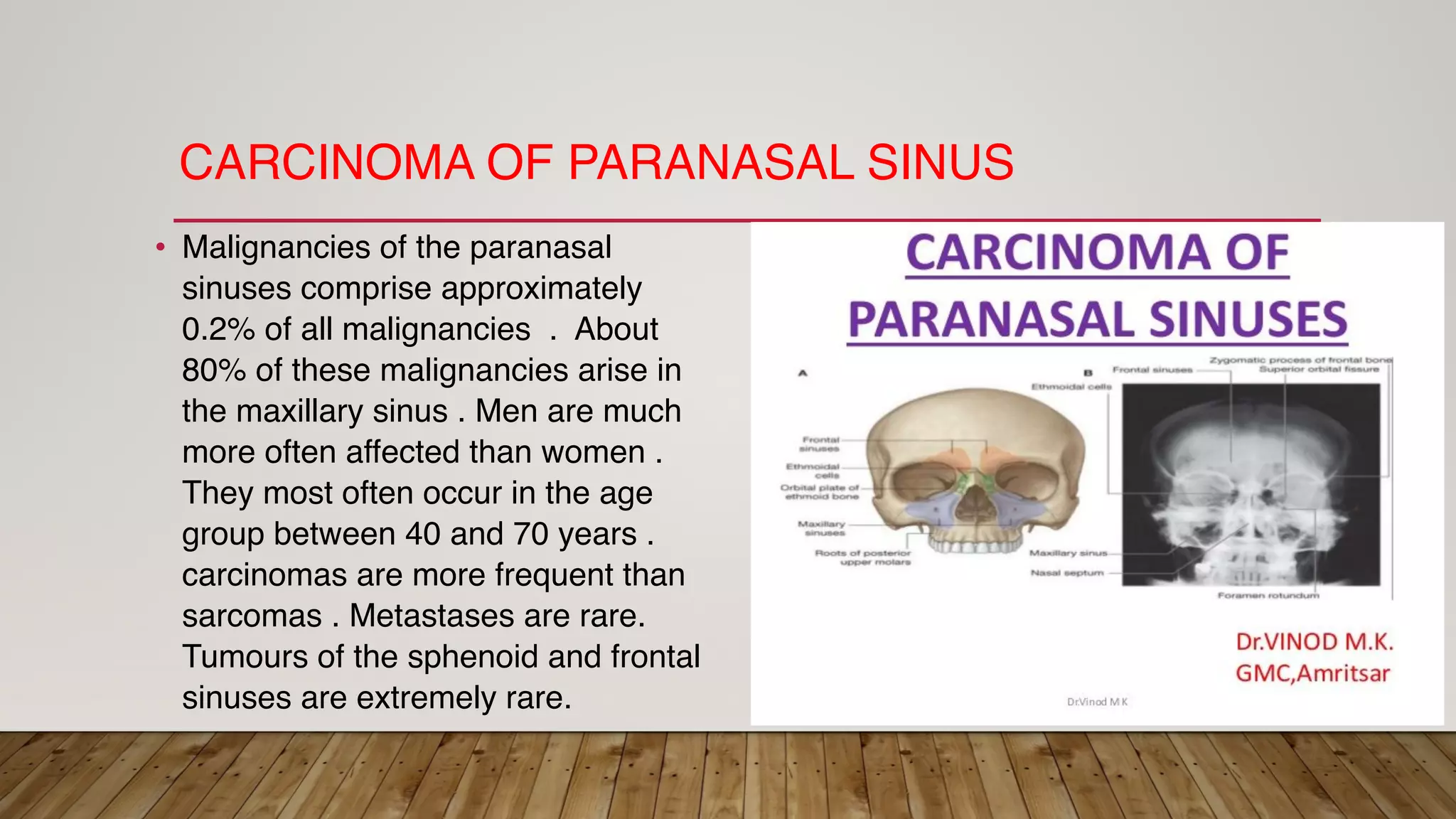 Anatomy of paranasal sinuses | PDF
