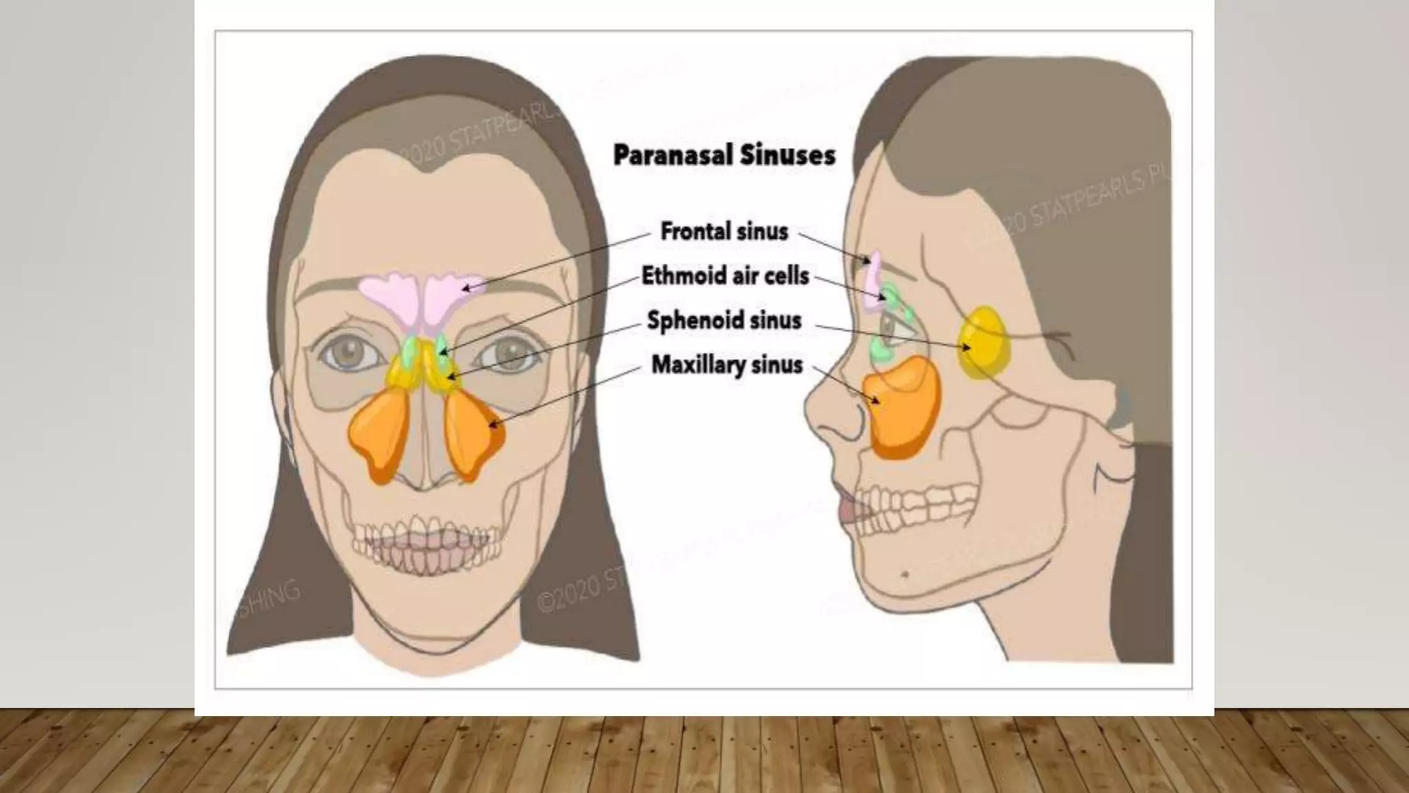 anatomy of paranasal sinuses.pptx