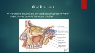 Surgical Anatomy of Paranasal Sinuses.pptx