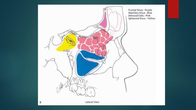 Surgical Anatomy of Paranasal Sinuses.pptx