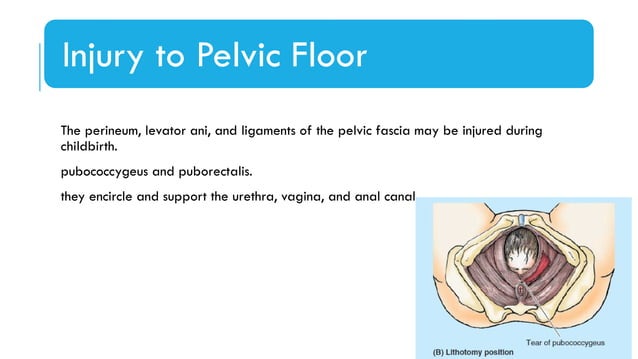 anatomy of pelvis, perineum and pelvic diaphragm.pptx | Free Download