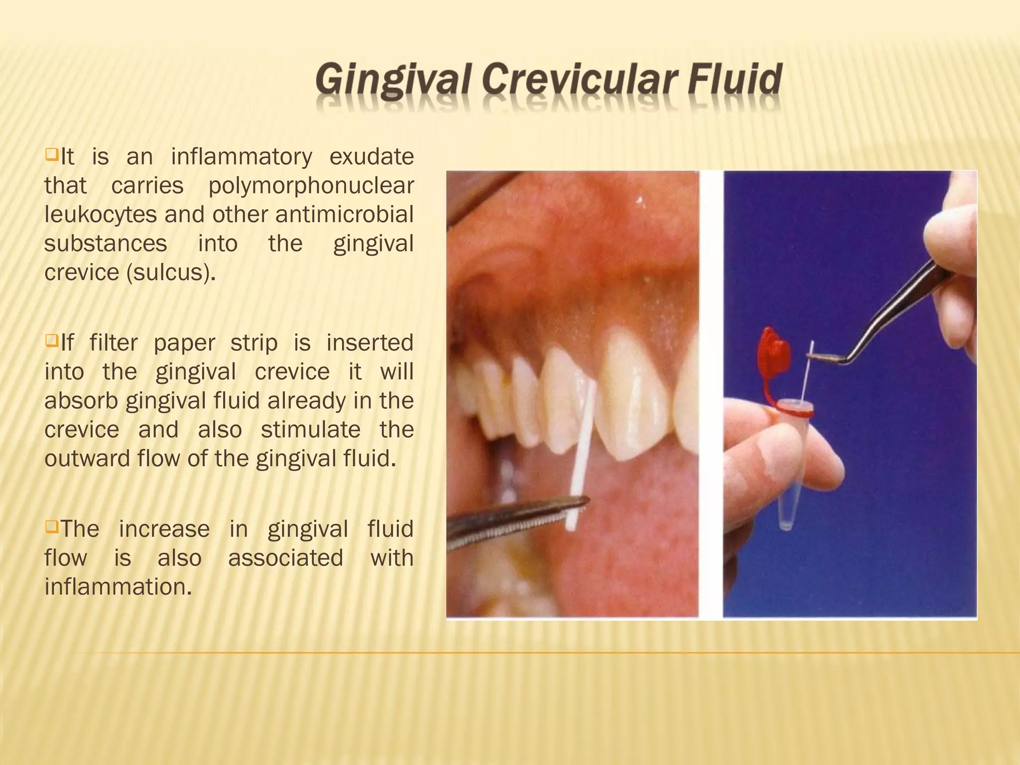 Anatomy of the Periodontium | PPT