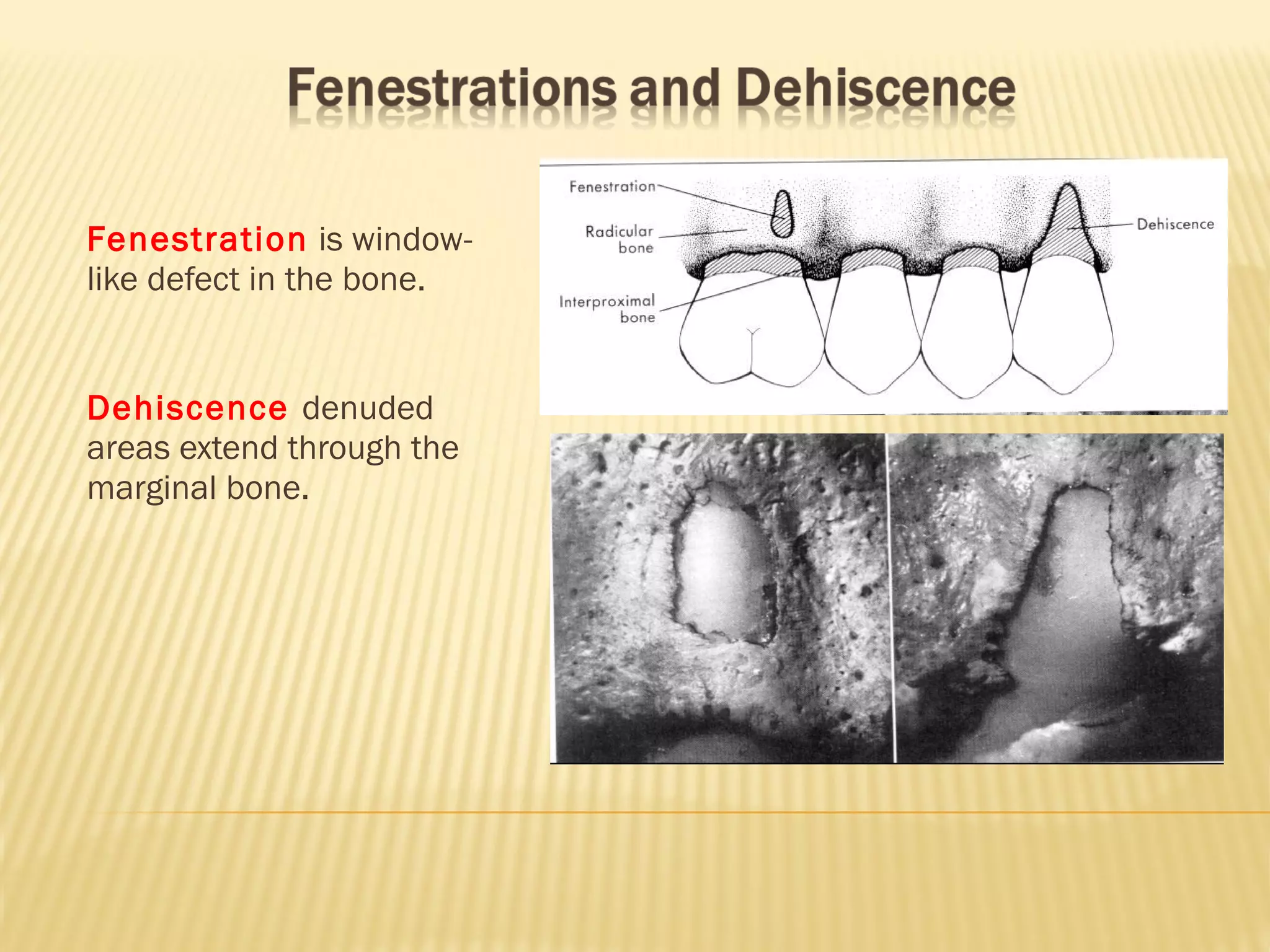 Anatomy of the Periodontium | PPT