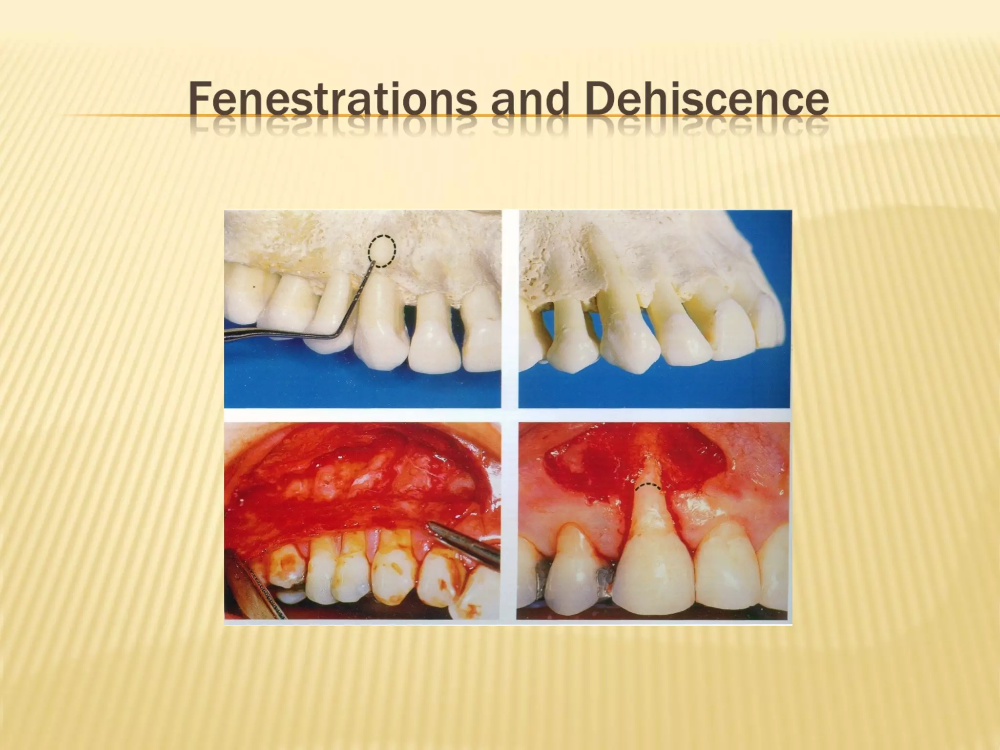 Anatomy of the Periodontium | PPT