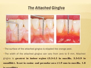 Anatomy of the Periodontium | PPT