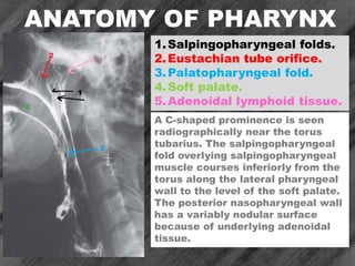 Anatomy of pharynx | PPTX | Death, Injury, or Military Conflict ...
