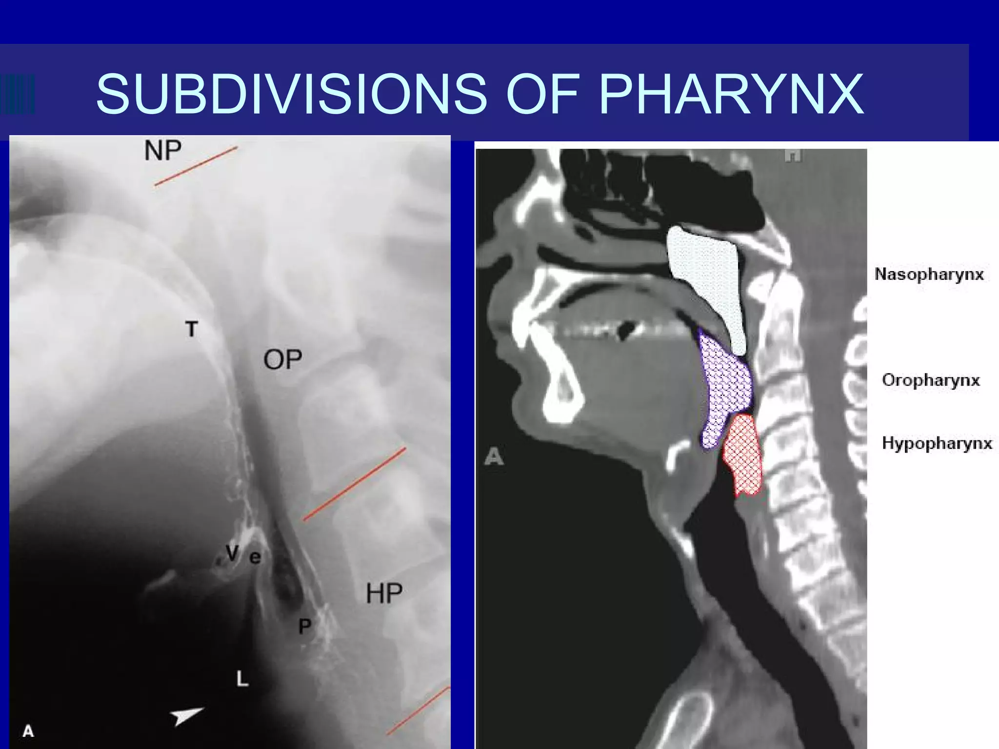 Radiological Anatomy of pharynx and esophagus abdul final | PDF