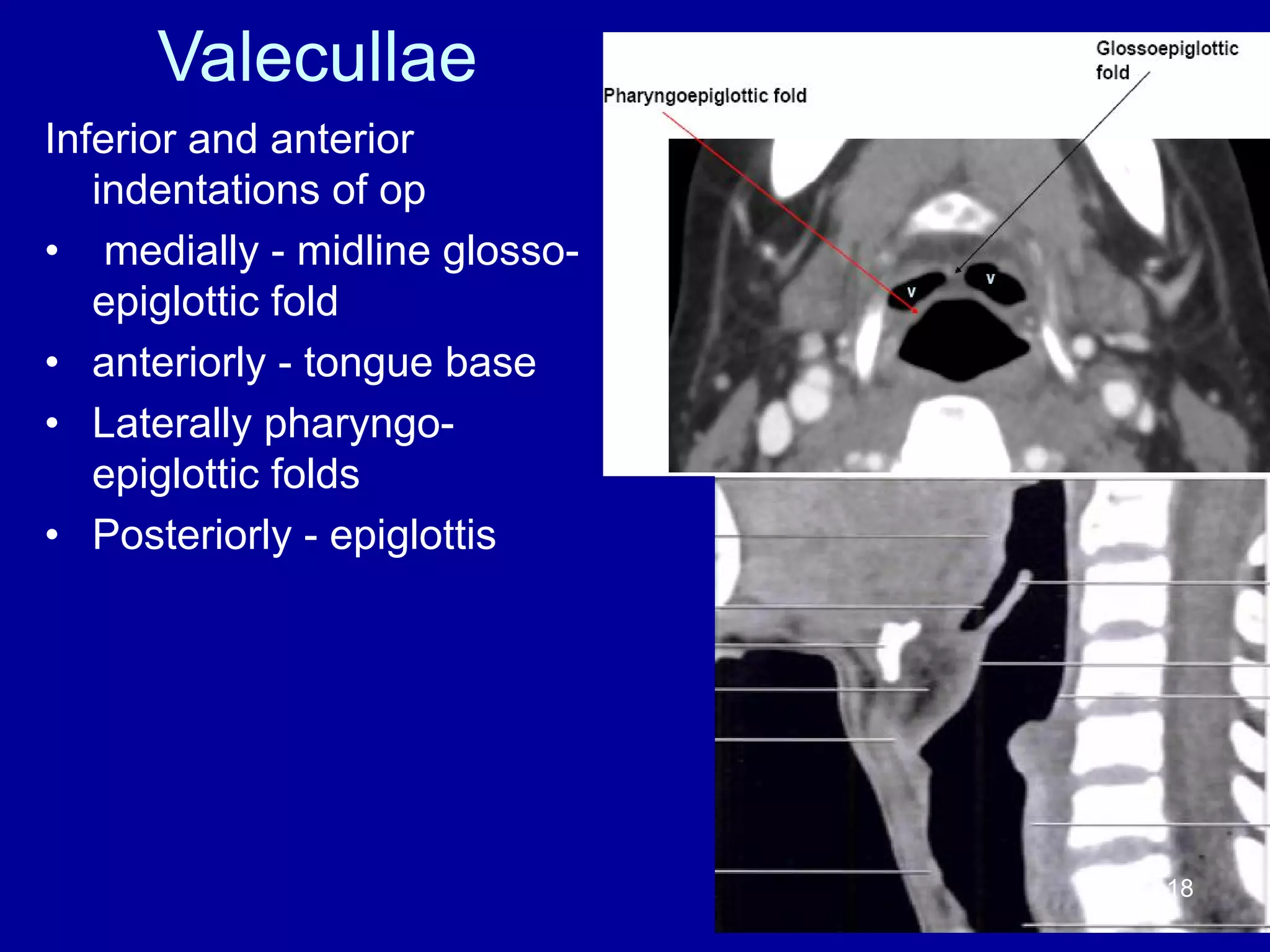 Radiological Anatomy of pharynx and esophagus abdul final | PDF