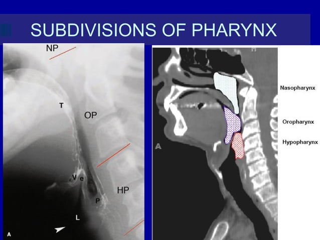 Radiological Anatomy of pharynx and esophagus abdul final