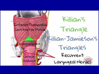 Killians Triangle