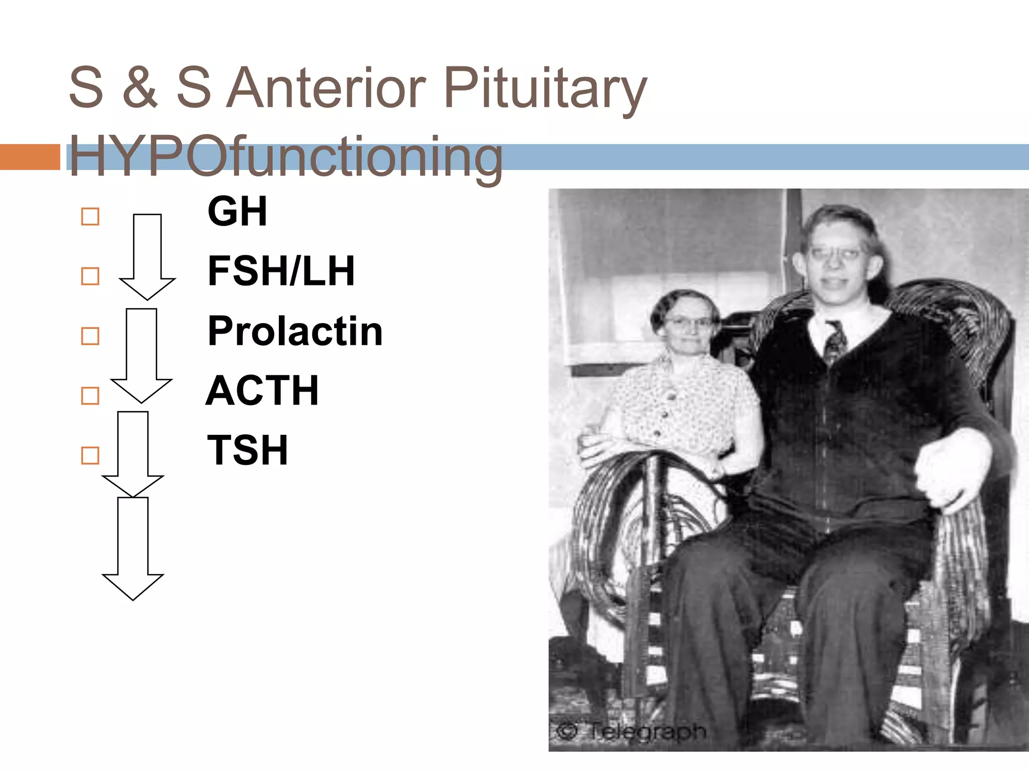 Anatomy of pituitary gland | PPTX