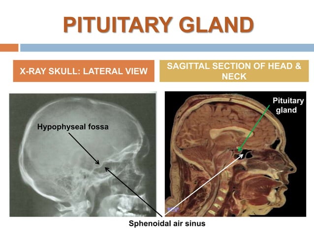 Anatomy of pituitary gland | PPTX | Pregnancy | Reproductive Health