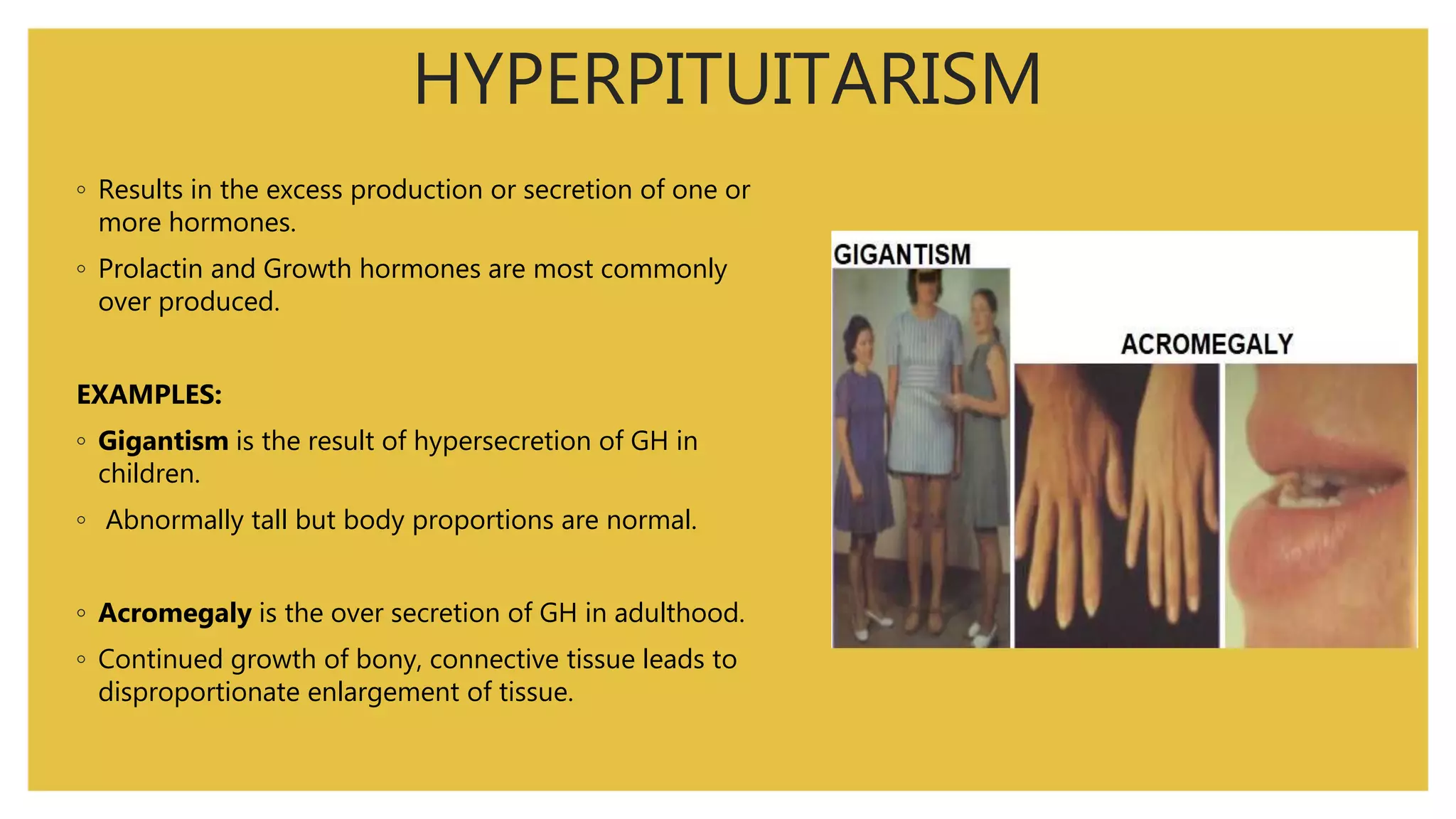 Anatomy of pituitary gland | PPTX