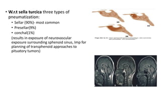 Anatomy of pns | PPTX