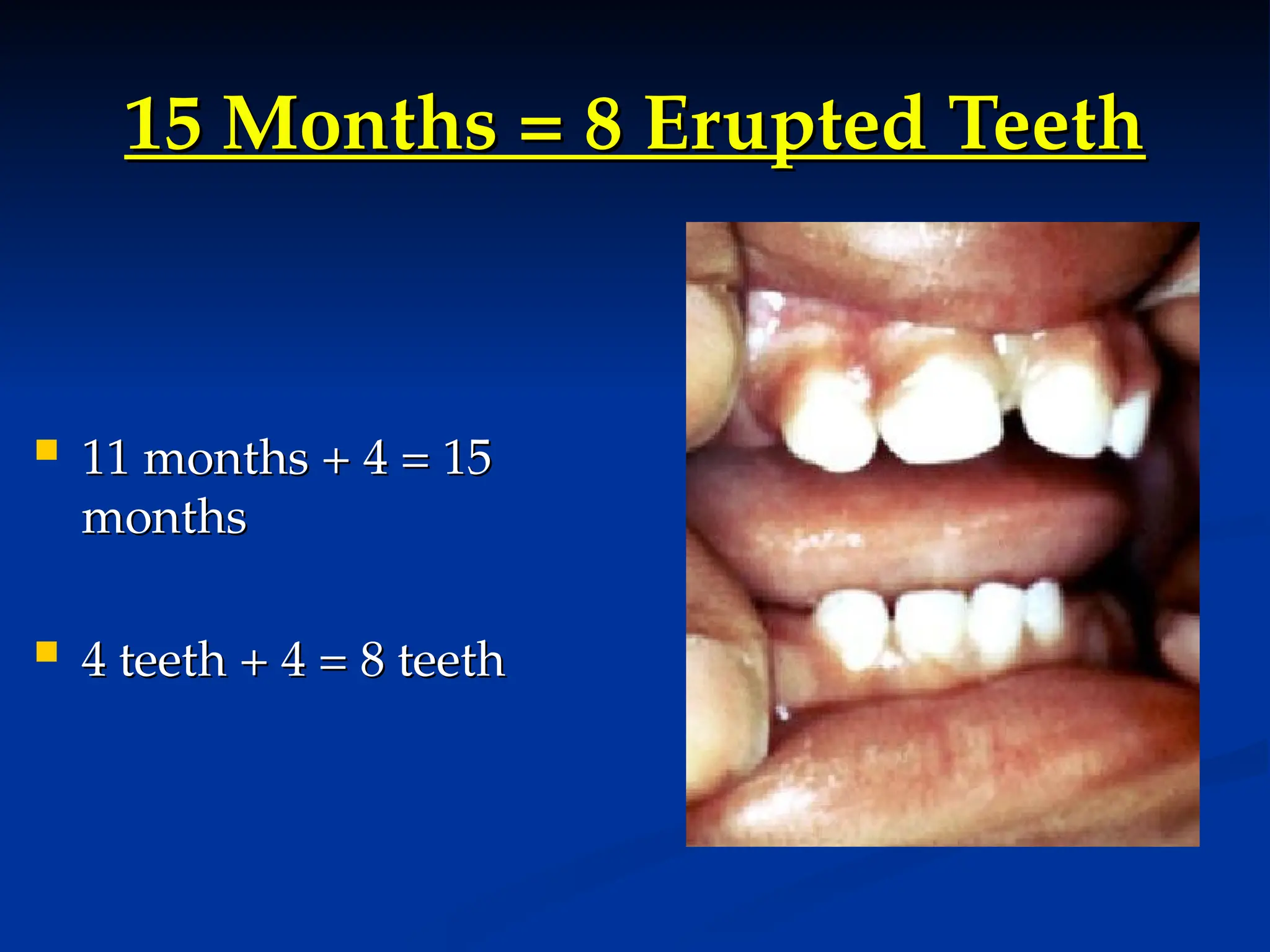 Anatomy of Primary Teeth age group 6mnth to 6.ppt