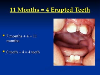 Anatomy of Primary Teeth age group 6mnth to 6.ppt