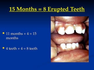 Anatomy of Primary Teeth age group 6mnth to 6.ppt
